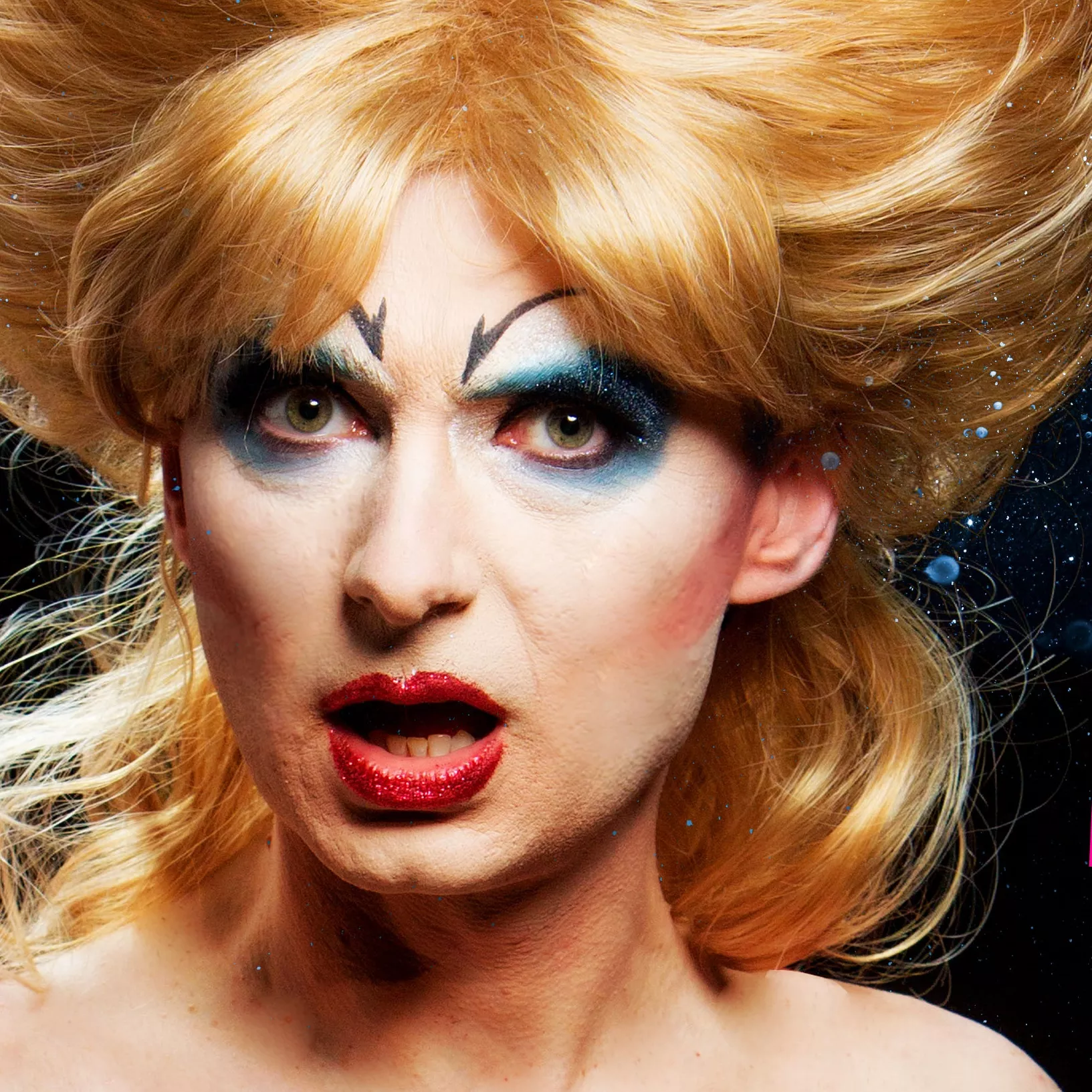 Hedwig Postponed Due to Injury